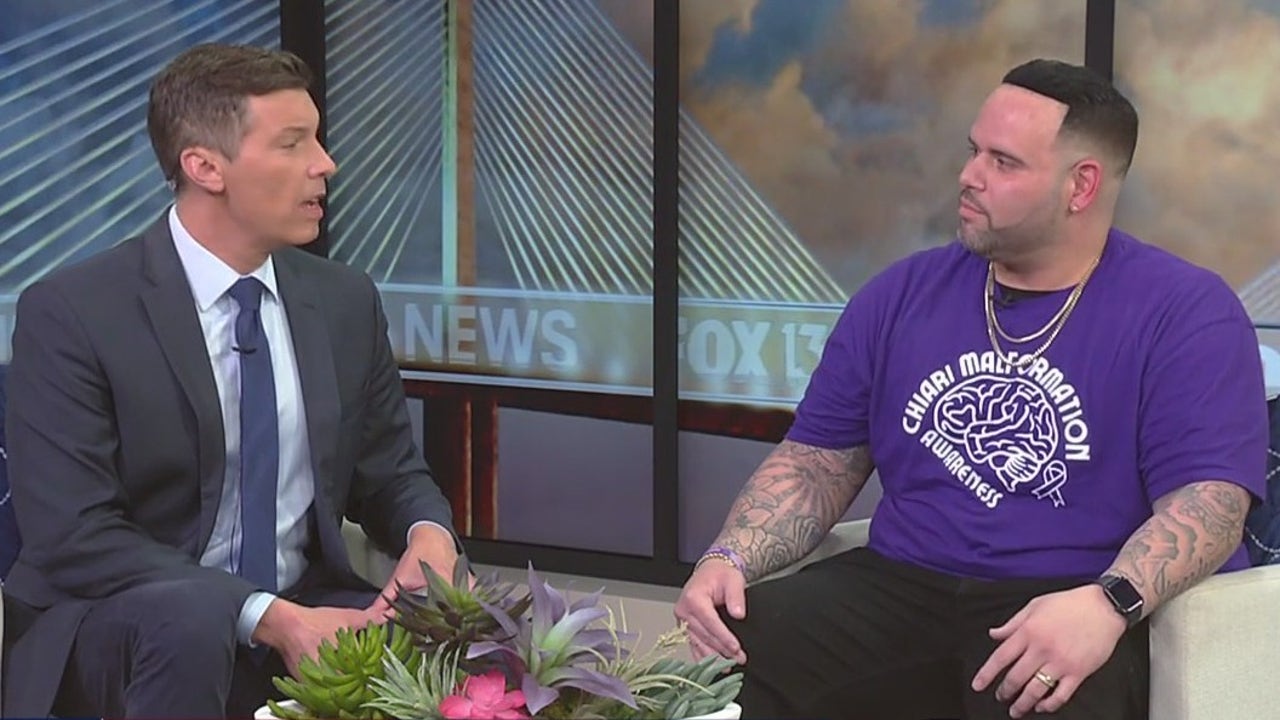 Conquer Chiari Walk Across America | FOX 13 Tampa Bay