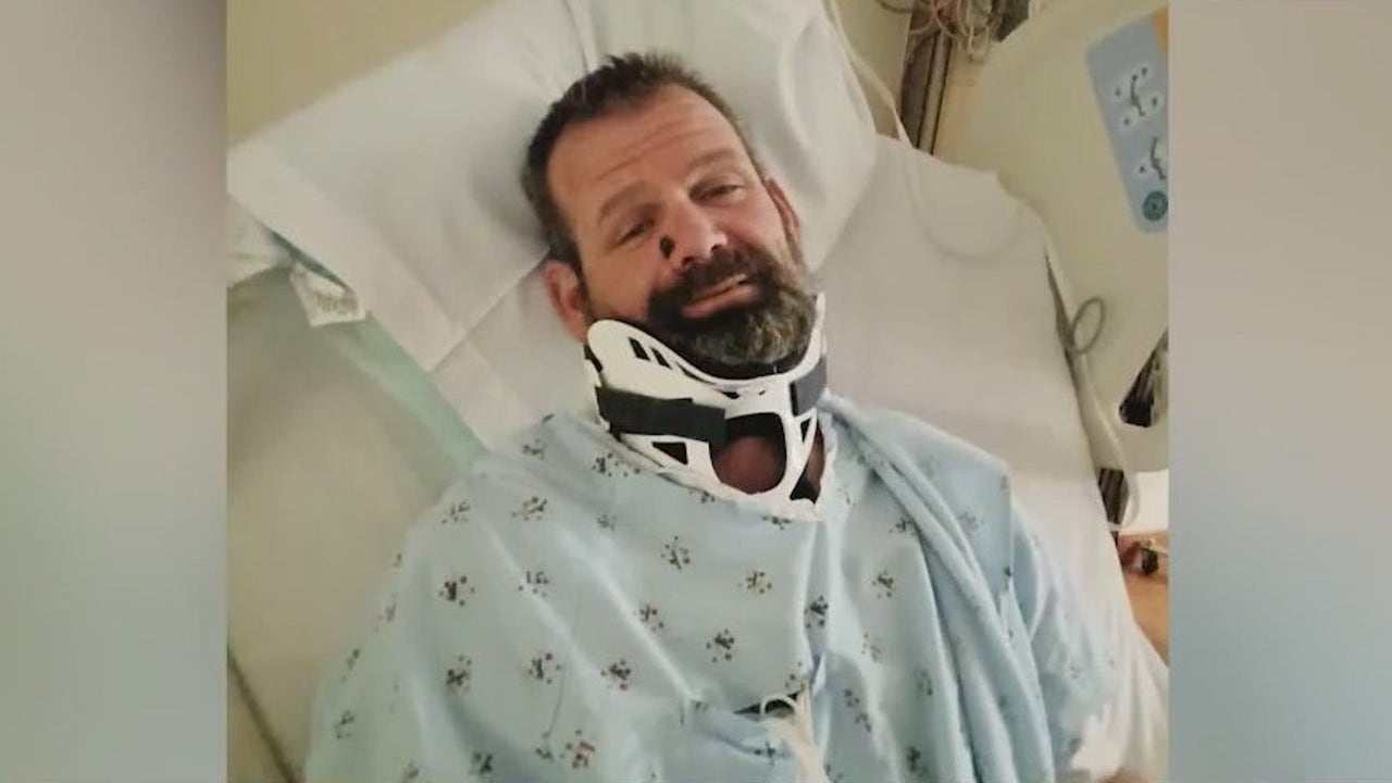 Man shot in head on road to recovery | FOX 51 Gainesville