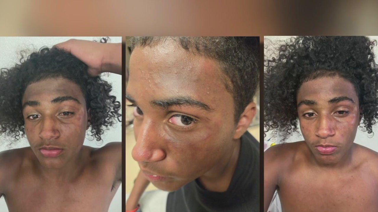 Pflugerville ISD student attacked on school bus by adults | FOX 7 Austin Pflugerville ISD student attacked on school bus by adults | FOX 7 Austin