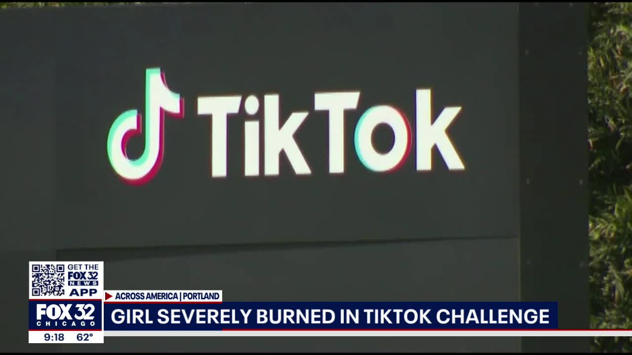 Oregon teen hospitalized with severe burns after attempting viral ...