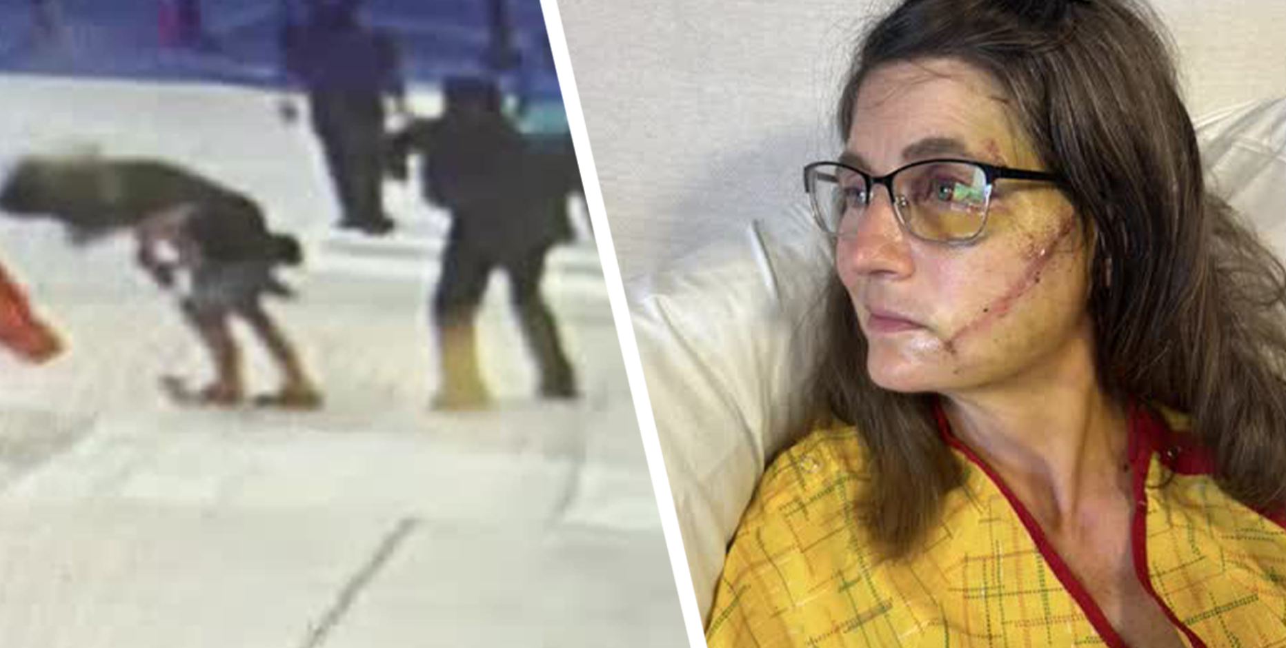 Man arrested for series of random attacks in Downtown Dallas | FOX 4 ...