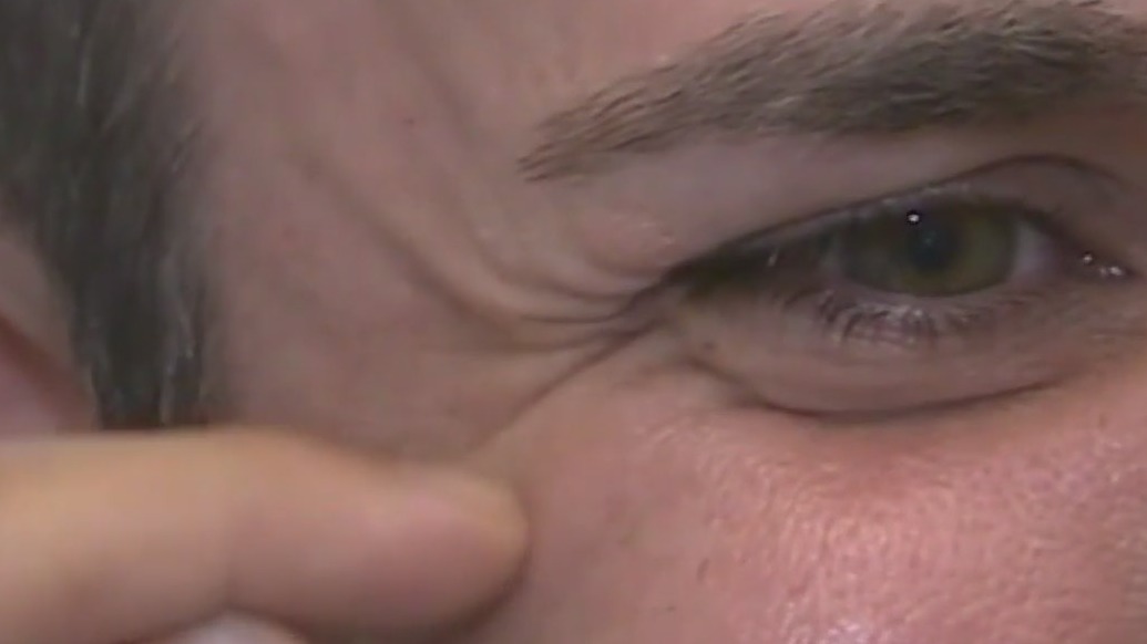 New book delves into the transformative history of Botox | FOX 32 Chicago