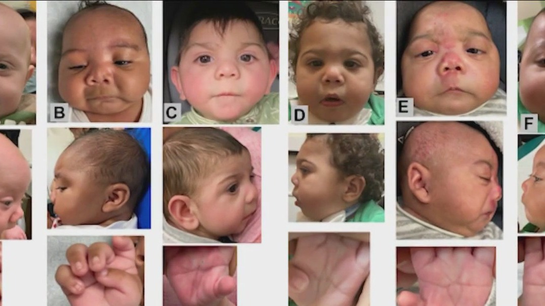 New syndrome in babies linked to fentanyl use | FOX 5 New York