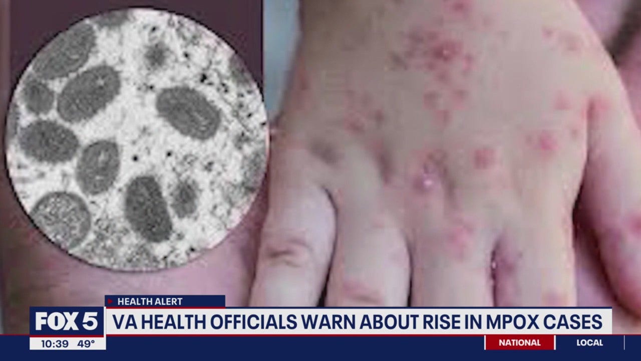 Virginia officials warn about rise in Mpox cases | FOX 5 DC