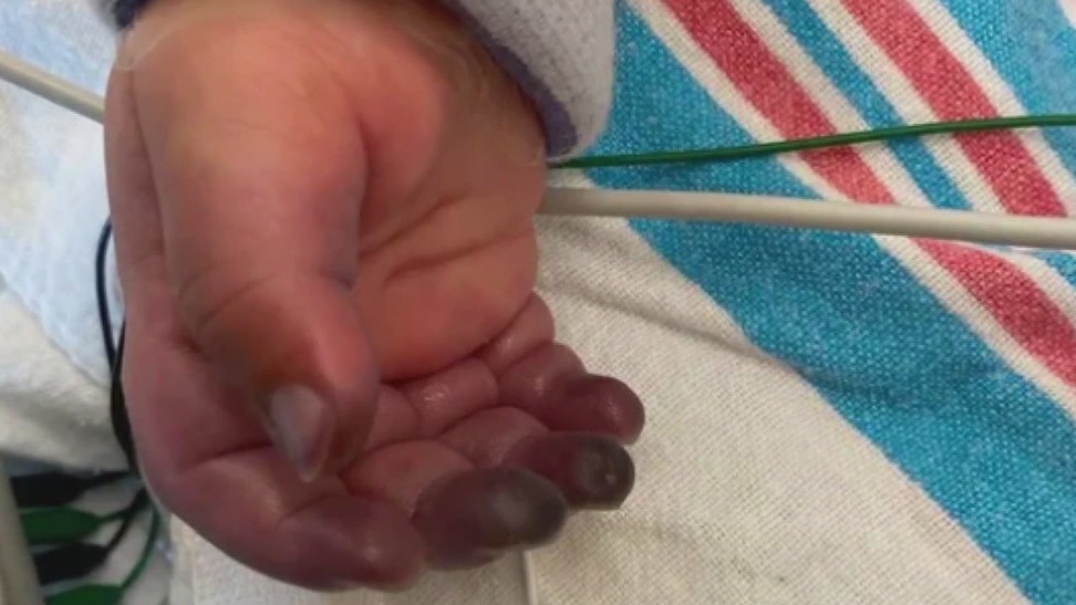 7-month-old hospitalized after alleged abuse by father | FOX 2 Detroit