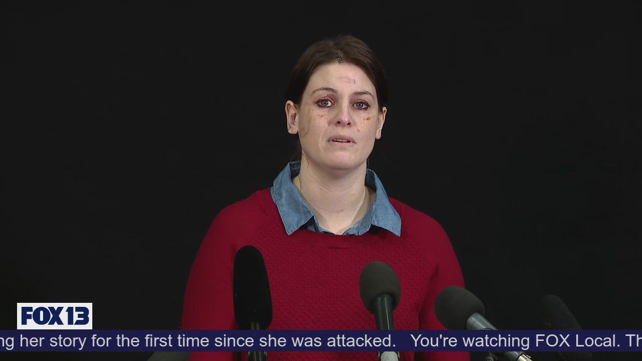 RAW: Point Defiance stabbing victim shares story of attack | FOX 13 Seattle