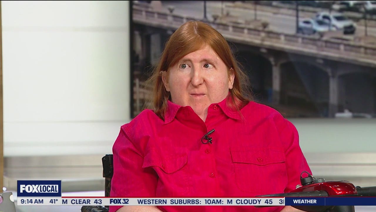 Disability rights advocate Melissa Blake talks about her new book ...