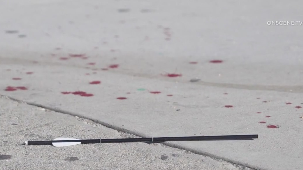 Man shot with arrow in Echo Park | FOX 11 Los Angeles