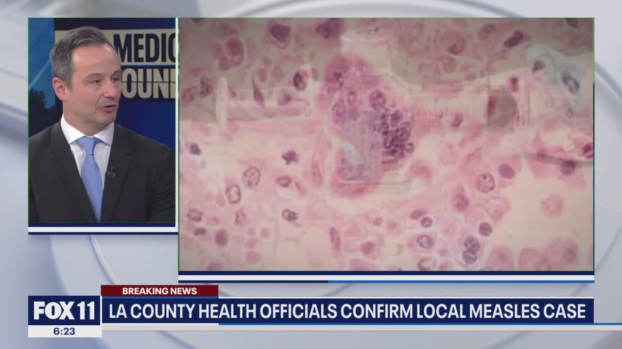 Infected person with measles confirmed in LA | FOX 11 Los Angeles