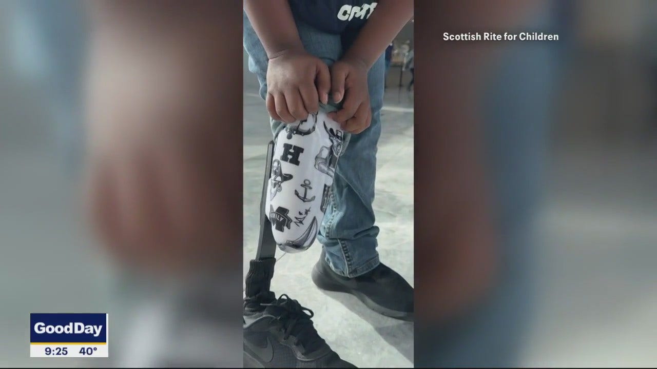 Young fan gets Dak's tattoos on his prosthetic leg | FOX 4 Dallas-Fort ...