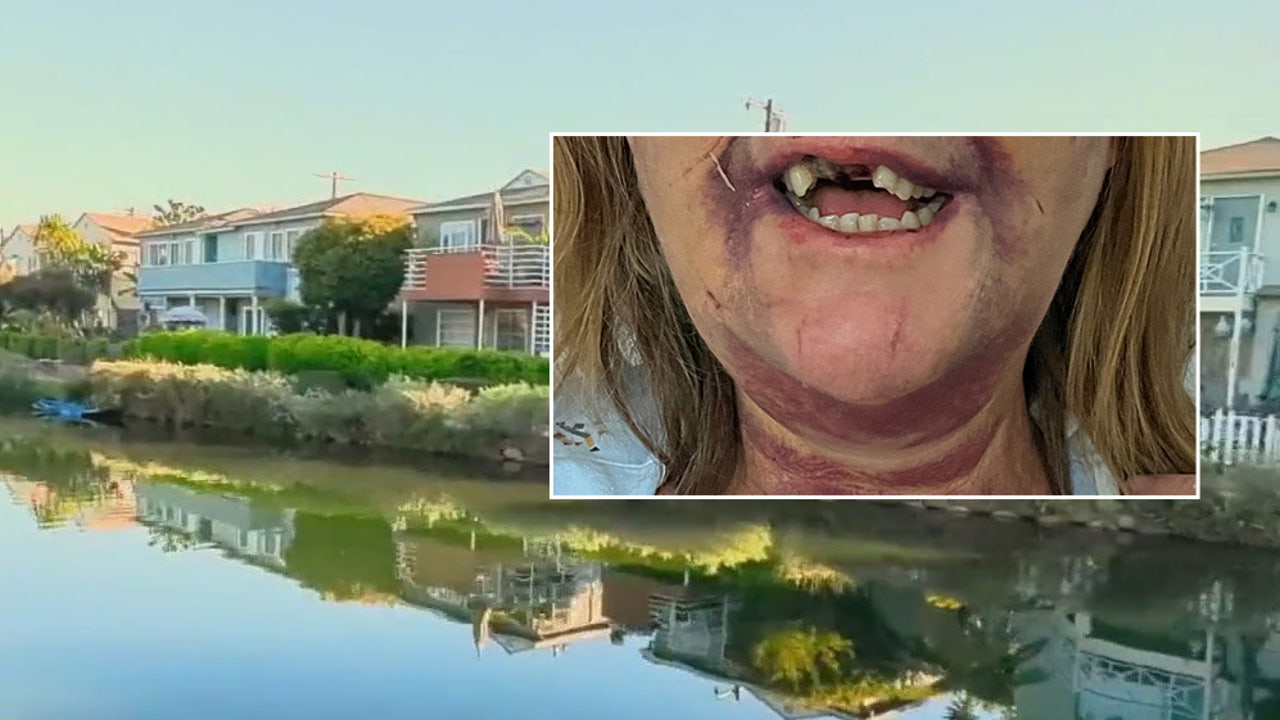 Venice Canals attacks suspect charged | FOX 11 Los Angeles