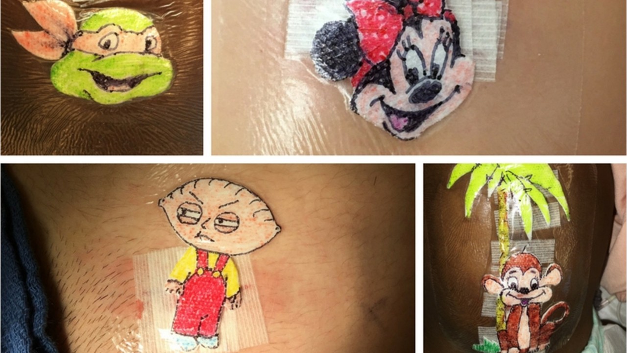 Doctor draws dressings of cartoons on young surgery patients | LiveNOW ...