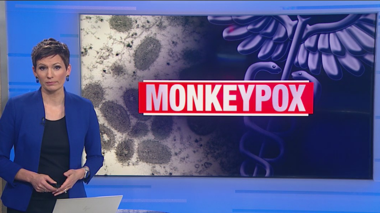 Monkeypox cases rising in Chicago, city's top doctor warns | FOX 32 Chicago