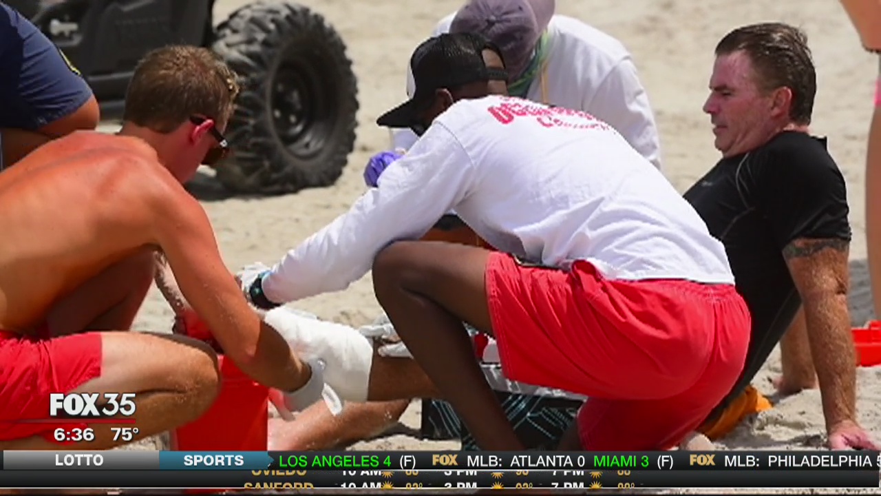 Shark bites surfer at Satellite Beach | FOX 35 Orlando