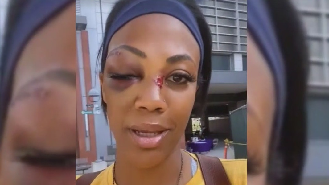 US Olympian Kim Glass allegedly attacked by homeless man in DTLA | FOX ...