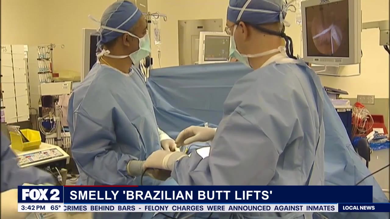 What is the 'BBL Smell' and is it real? | FOX 2 Detroit