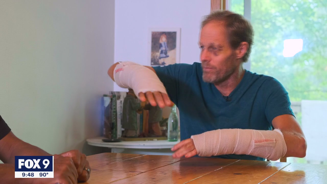 Minnesota Renaissance Festival juggler recovering after fall | FOX 9 ...