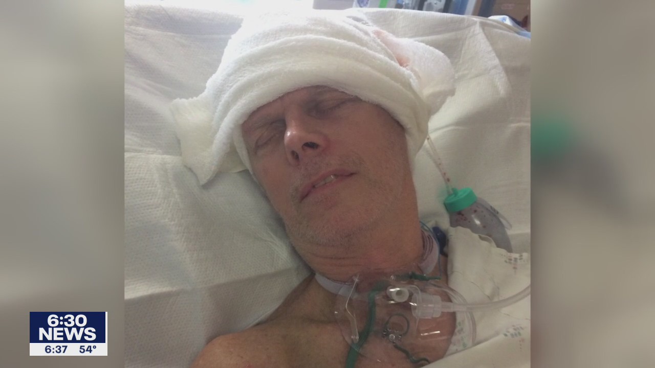Businessman Henry Bromelkamp on the road to recovery from brain injury ...