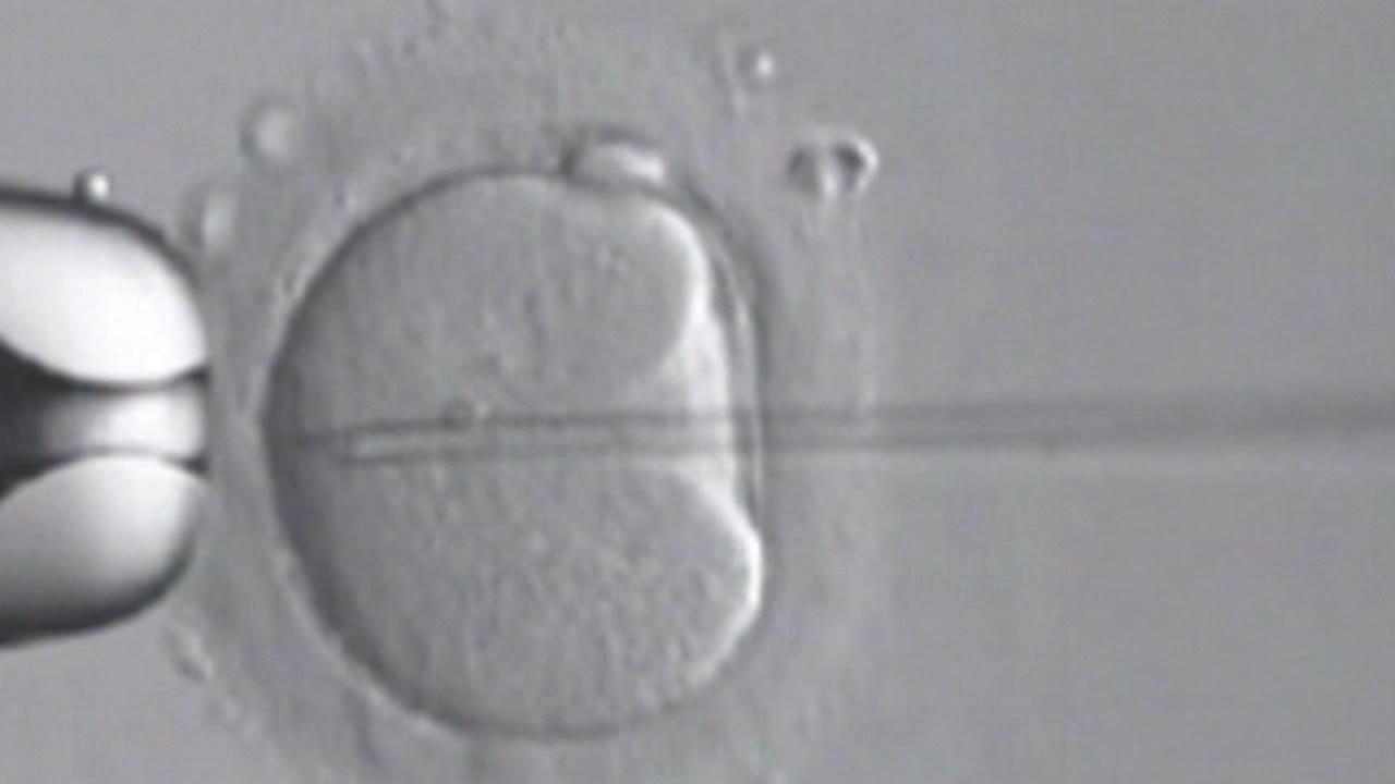 AL court ruling on embryos leaves some worried | FOX 10 Phoenix