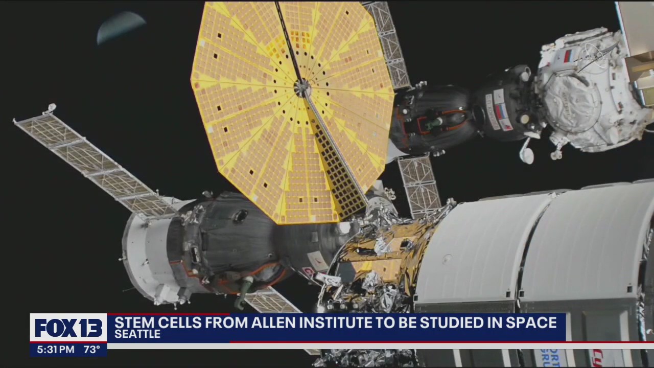 Stem cells from Seattle's Allen Institute to be studied on private ...