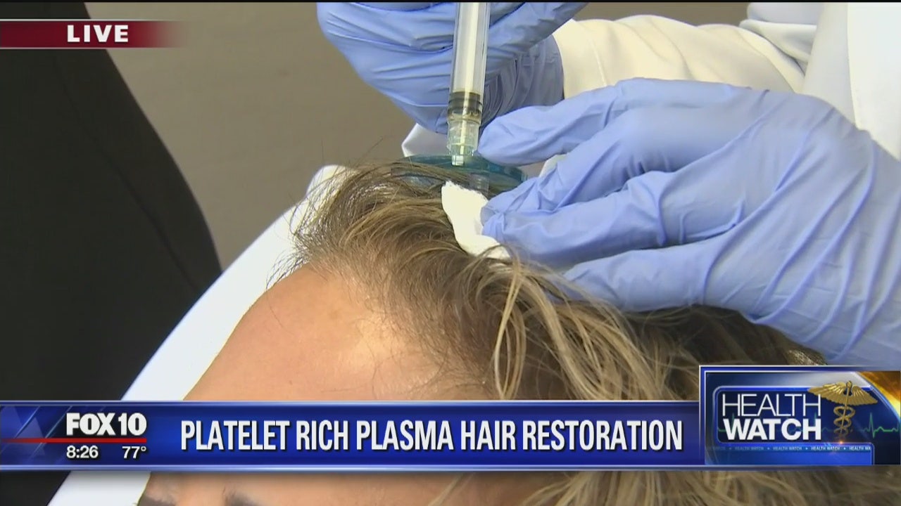 Platelet rich plasma hair restoration