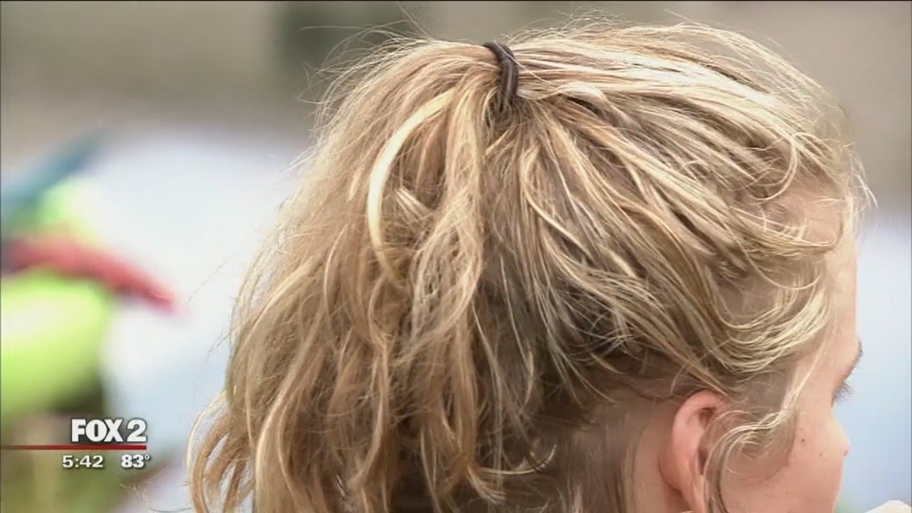 Ponytail headache could lead to greater issues