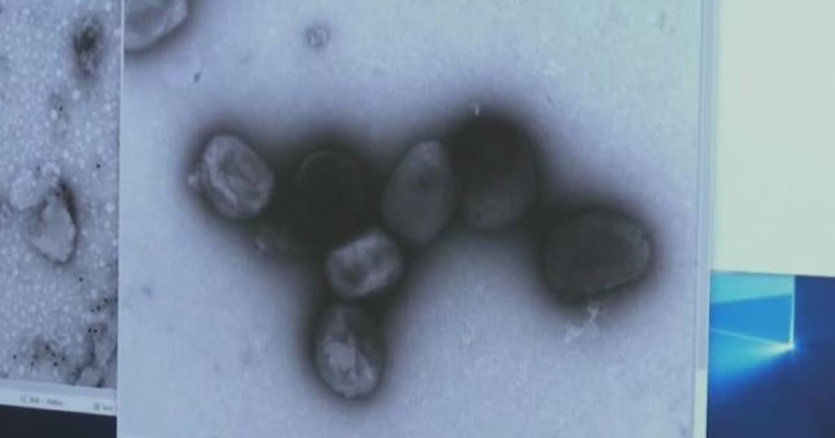 US health officials warn monkeypox could mutate to resist antiviral ...