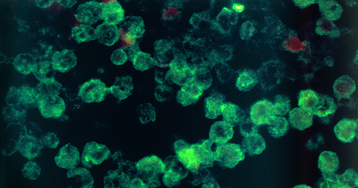 Health officials rule out suspected ‘Brain-eating amoeba’ case in ...