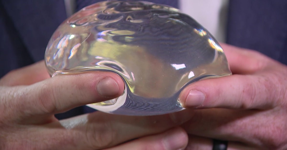 Explantation: More women choosing to remove their breast implants | FOX 10 Phoenix