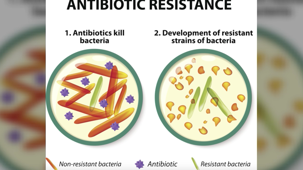 Superbugs are a global threat. Here's what we can do about them | FOX ...