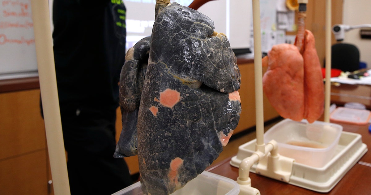 Tampa mayor urges lung cancer screenings | FOX 13 Tampa Bay