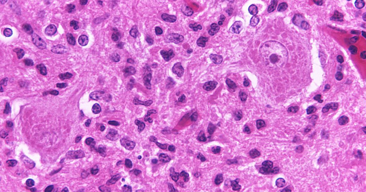Rabies alert issued in Hillsborough County after stray cat tests ...