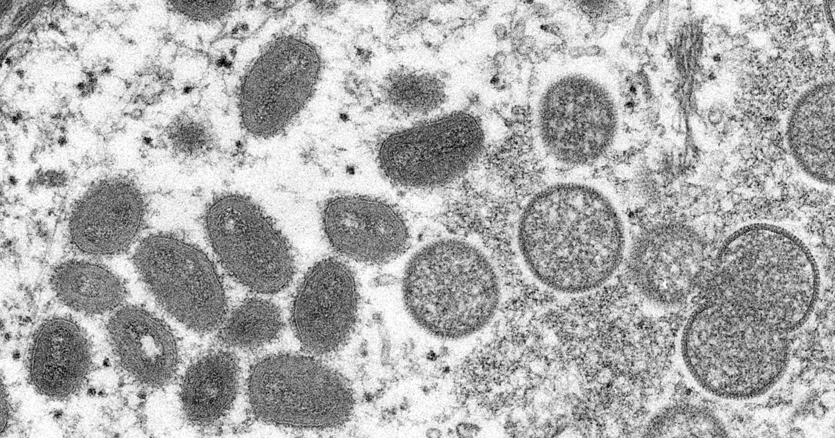 CDC warns mpox resurgence possible amid rise in cases | FOX 13 Tampa Bay
