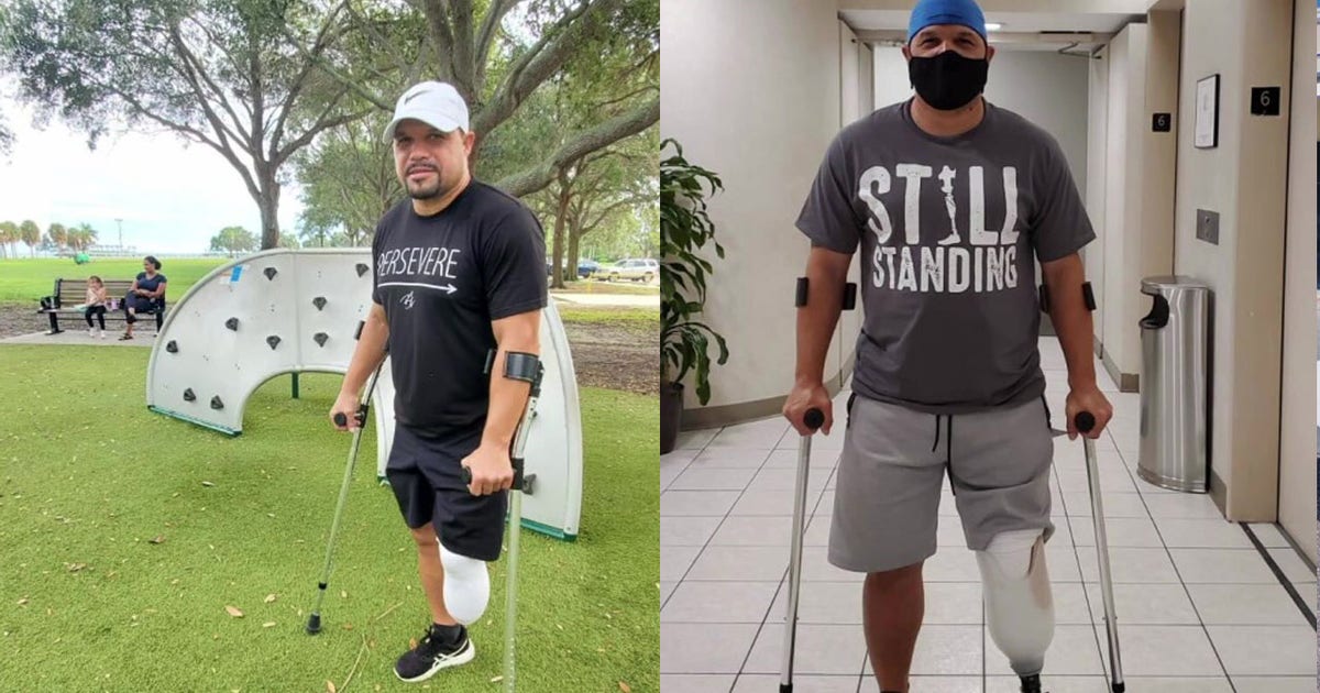 Former soccer pro uses loss of leg to inspire on and off the field ...