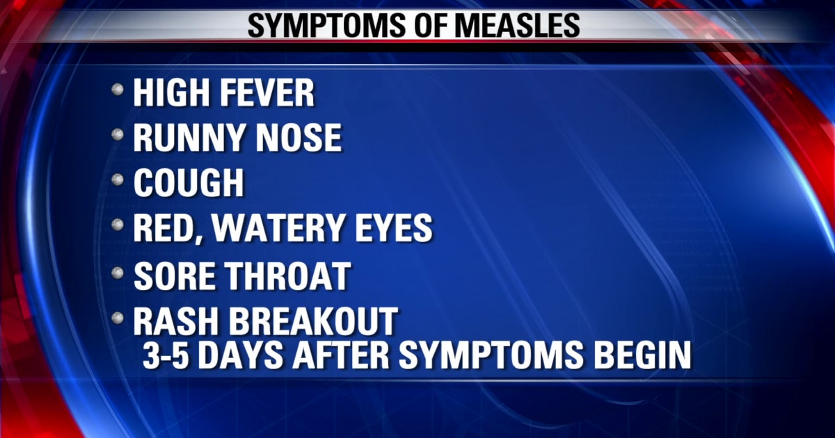 5 measles cases confirmed in Harris, Galveston, Montgomery counties ...