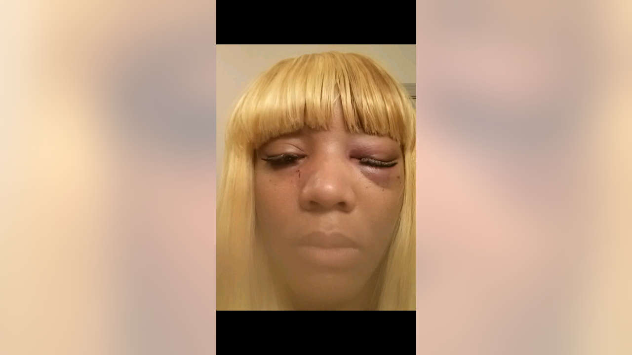 From Victim to Victor: Woman Shot By Boyfriend Shares Her Story | FOX ...