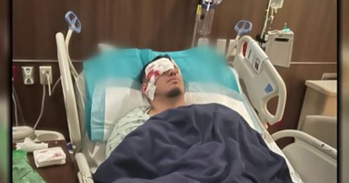 Houston man allegedly shot nephew in the head three times, out on $200K ...