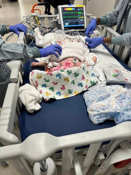 Kylie Overfield, toddler who underwent rare double-lung transplant in ...