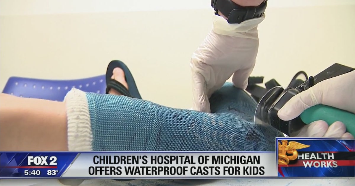 Wearing a cast used to mean a summer of no fun. Now, waterproof casts ...