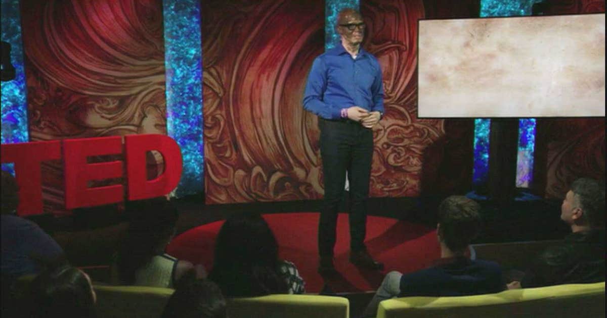 Lee Thomas gives TED Talk about learning positivity through vitiligo ...
