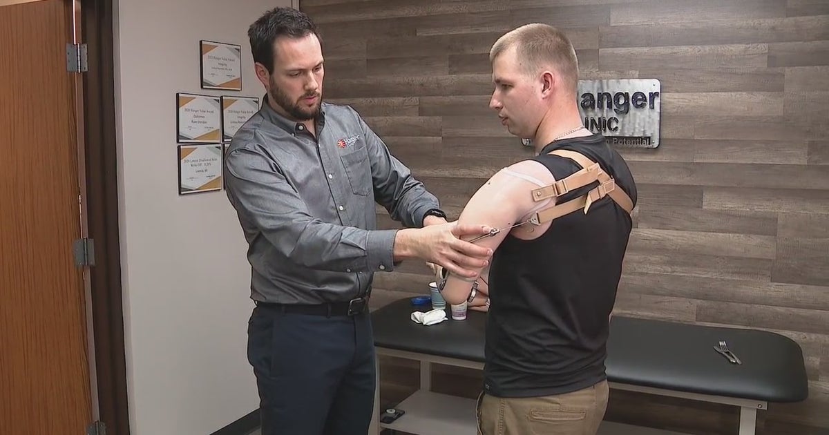 Ukrainian soldier travels to Metro Detroit for prosthetic arm after ...