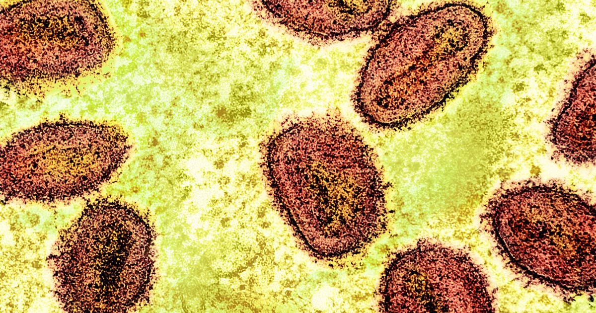 Foreign nationals working at NIH charged with smuggling monkeypox into ...