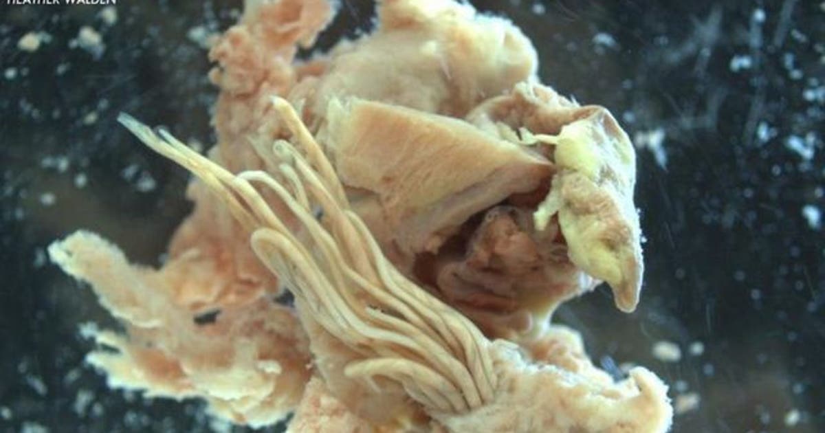'Alarming' rat lungworm parasite spreading through Florida, researchers ...