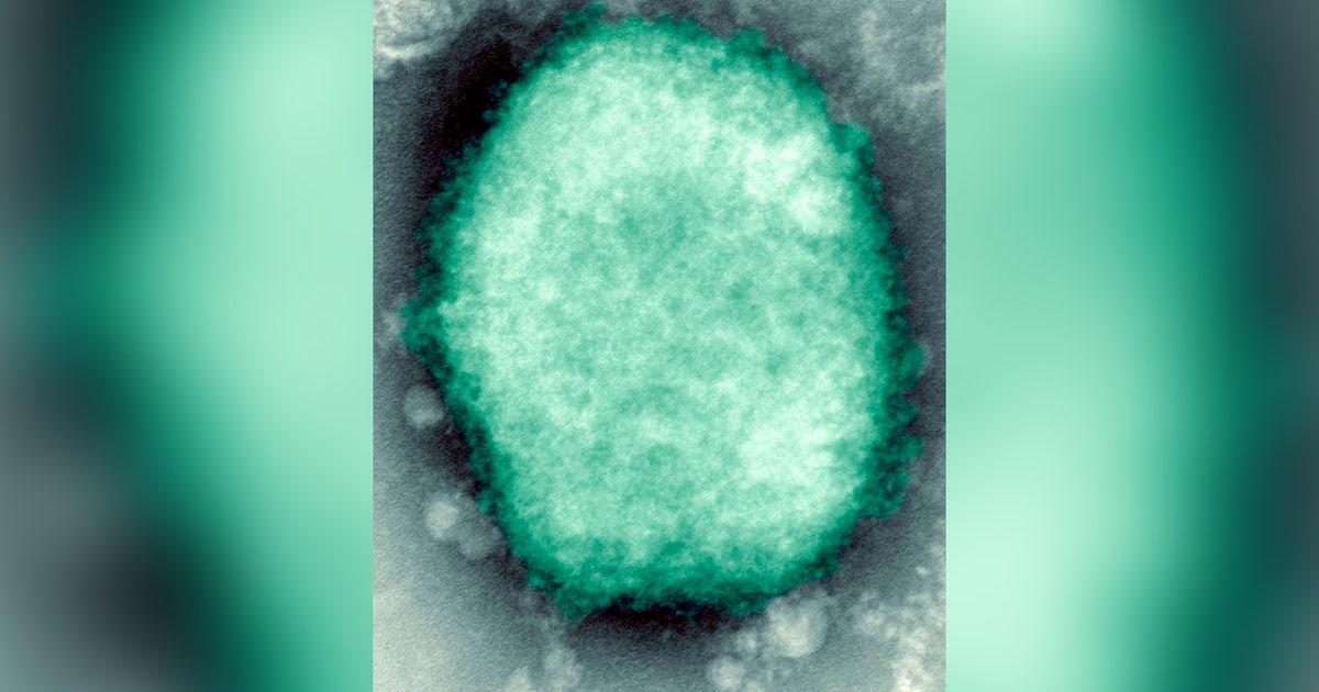 Monkeypox contributed to Indiana resident’s death, officials say | FOX ...