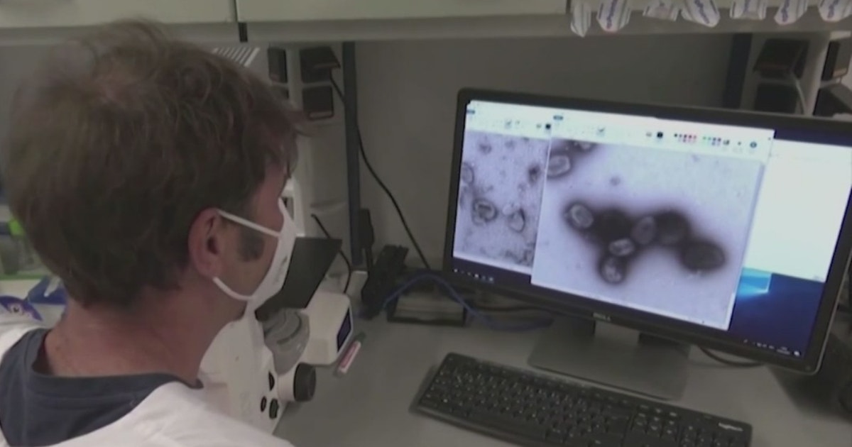 More than 100 monkeypox cases reported in Chicago area | FOX 32 Chicago