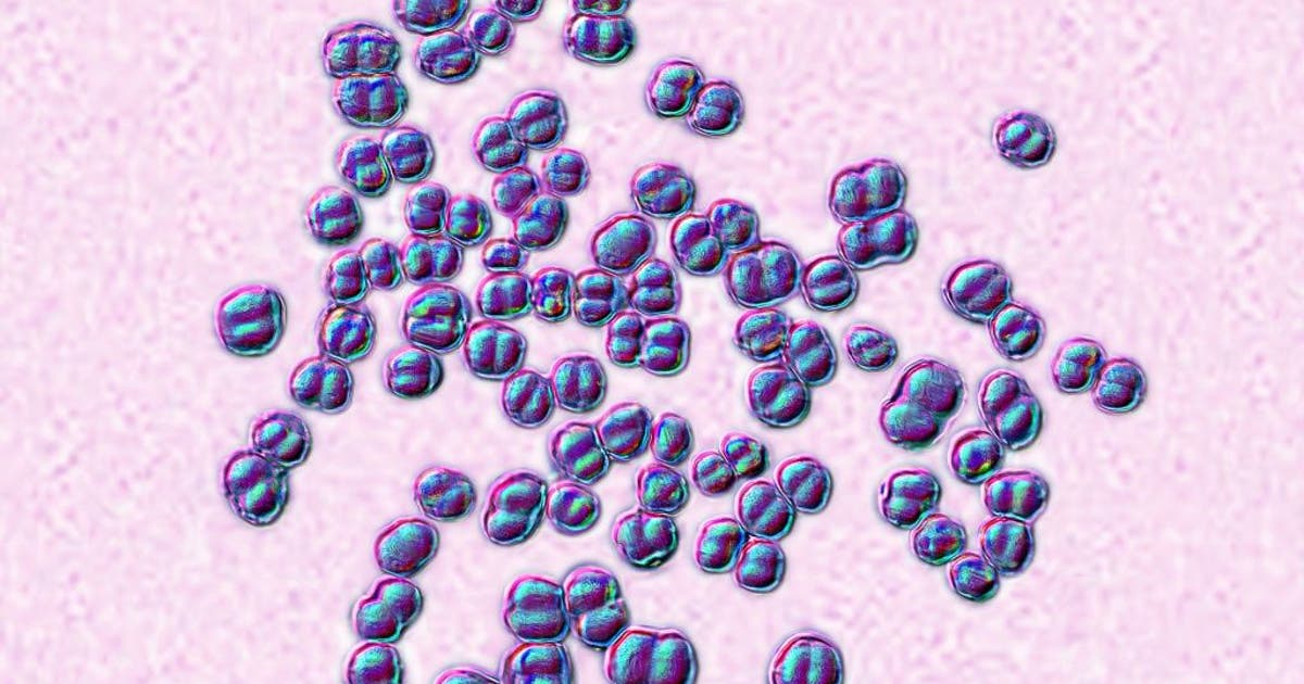 7 meningitis cases reported in Chicago this month, including 2 deaths ...