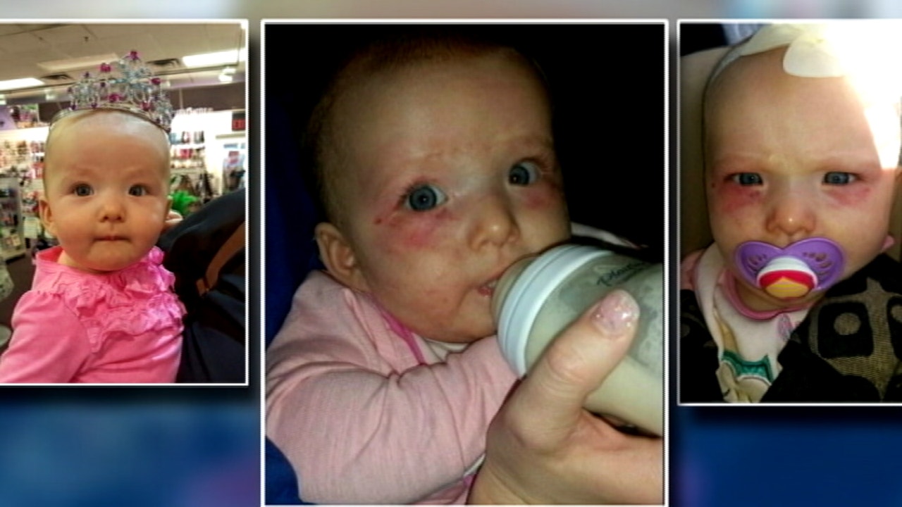 Babysitter accused of abusing 6-month-old North Texas girl | FOX 35 Orlando Babysitter accused of abusing 6-month-old North Texas girl | FOX 35 Orlando