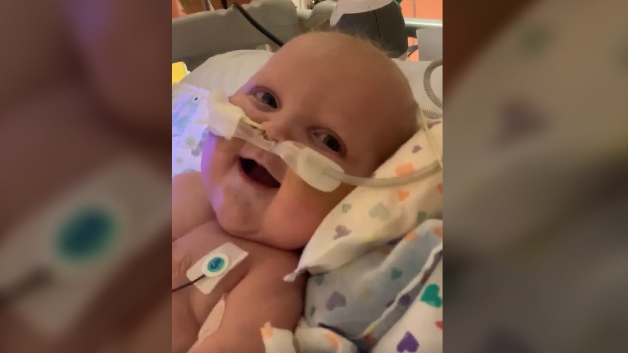 Baby born with half a heart smiles for the very first time after 2nd ...