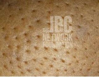 orange texture breast