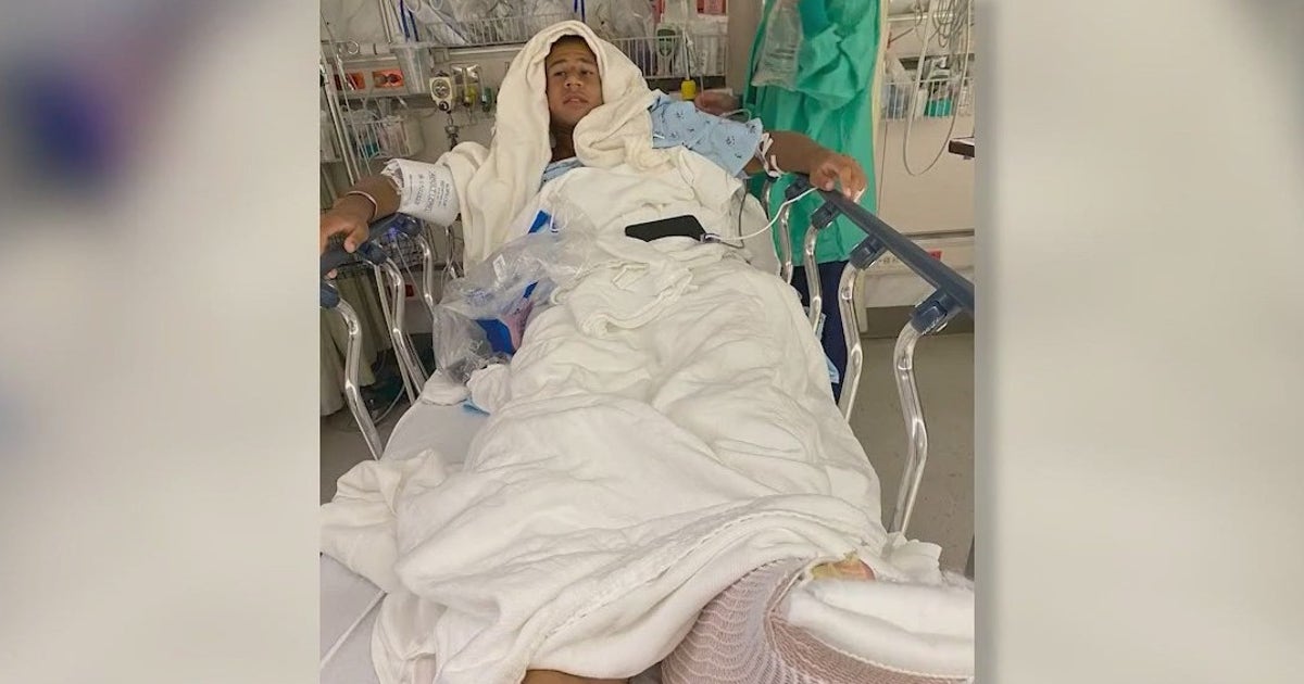 ‘Dragged me under’: Shark attack survivor credits close friend for ...